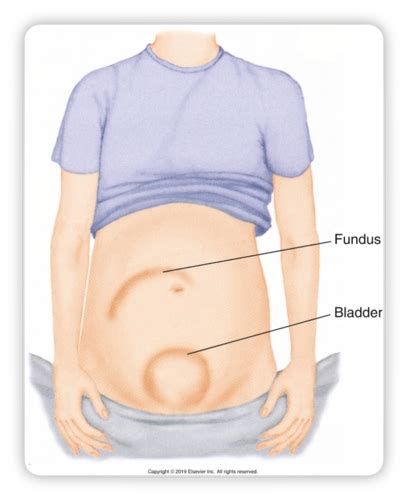 UNIT 13 NURSING PROCESS ASSESSMENT URINARY Flashcards Quizlet