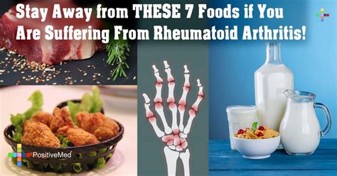 THESE 7 Foods If You Are Suffering From Rheumatoid Arthritis