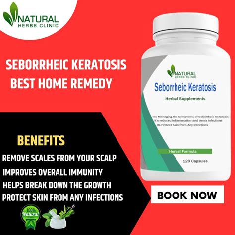Seborrheic Keratosis Utilize Various Natural Treatments That Helpful