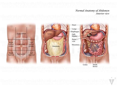 CASE AT A GLANCE Bowel Obstruction Acute Respiratory Distress