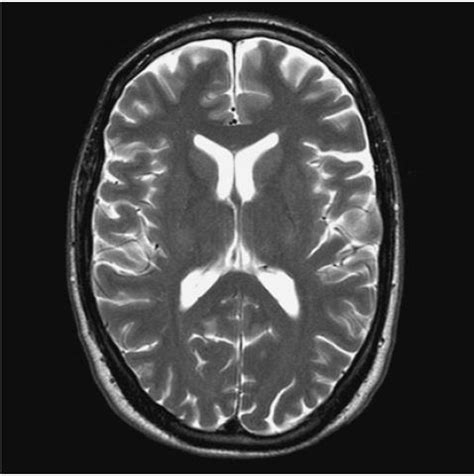 Mri Brain Anatomy Axial Diagram Quizlet Off