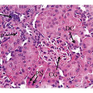 Photomicrographs Of Kidney Sections Of Different Experimental Groups