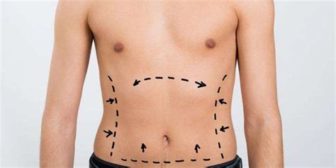 Tratamientos de cirugía estética para hombres en 2024