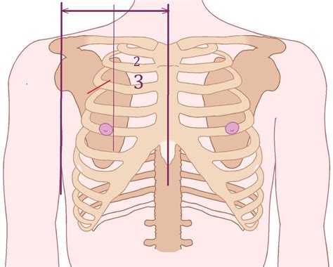 How To Count Intercostal Spaces