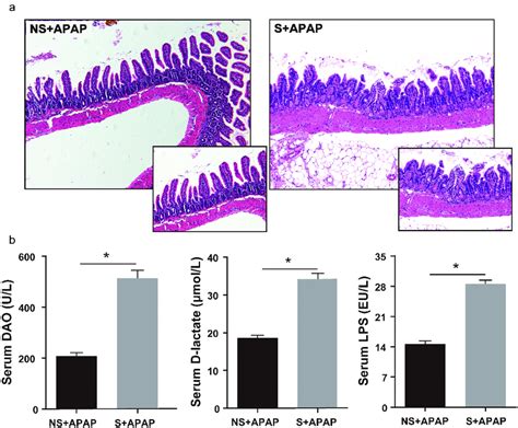 Significantly Increased Intestinal Permeability In Circadian Rhythm