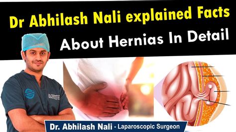 Health Facts About Hernias Hernia What It Is Types Causes And