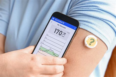 Is The Blood Glucose Tracking Wearable Technology Trend Worthwhile
