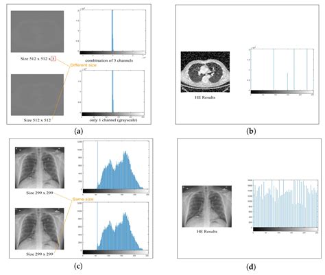 applied sciences free full text advanced medical image segmentation enhancement a particle