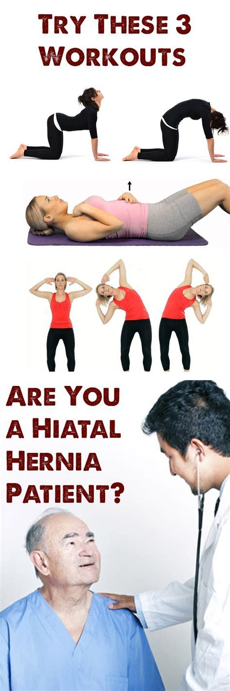 26 Hernias And Abdominal Exercises References Abdominal Exercises