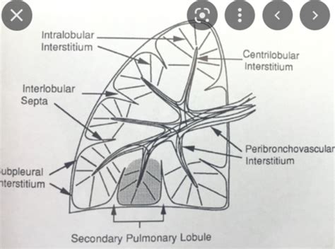 Chest Radiography Continued Flashcards Quizlet