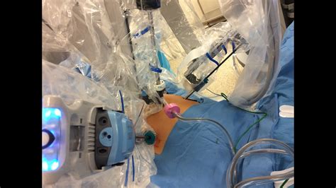Robotic Inguinal Hernia Repair Anatomy