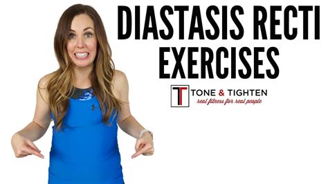 Physiotherapy For Diastasis Recti Dear Adam Smith