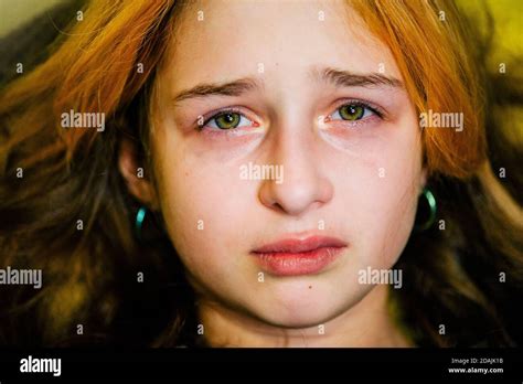 Little Sad Girl After Crying Crying Little Beautiful Girl With Sad Green Eyes And Frowning Face