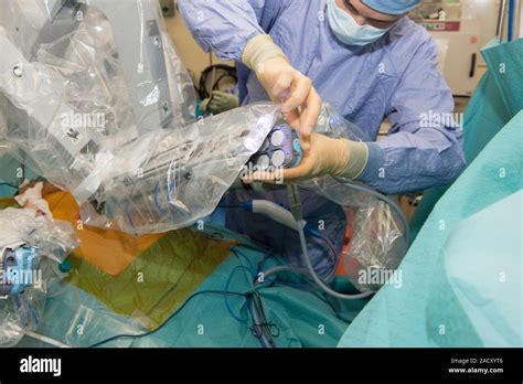 Da Vinci Robotic Prostatectomy Removal Of All Or Part Of The Prostate