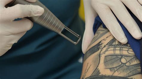 Eliminación de Tatuajes Instituto JAIM