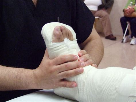 Sustentabilidad Fracturas De Tobillo Y Mu Eca Las Lesiones M S