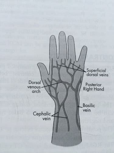 IV Therapy Flashcards Quizlet