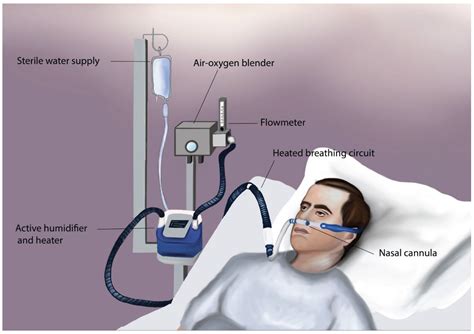 High Flow Oxygen Nasal Cannula Best Sale Cityofclovis Org