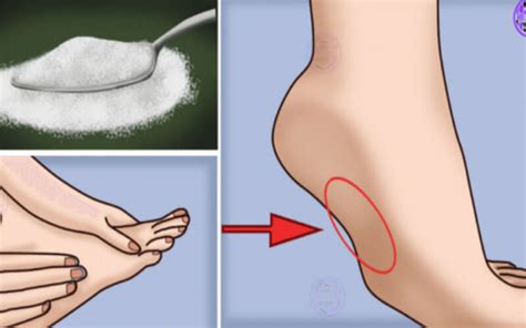 7 Signes Que Vous Mangez Trop De Sucre Toutes Recettes