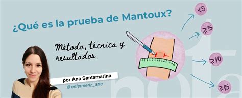 Qué es la prueba de Mantoux On enfermería
