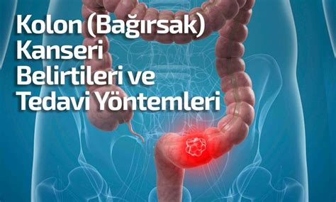 Kolon Kanseri Belirtileri Etiket Payla Mlar Sagliksitem