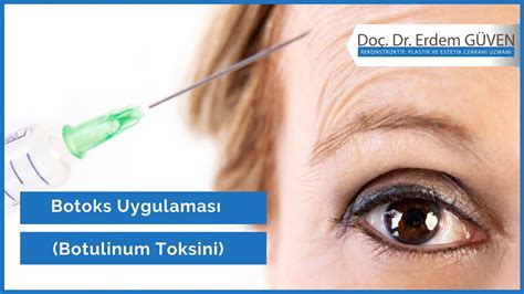 Botoks Uygulamas Botoks Uygulmas Nedir Botulinum Toksini Do