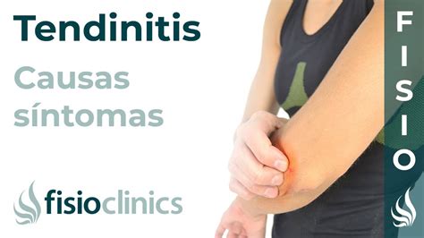 Qu Es La Tendinitis O Inflamaci N De Tend N Y Cu Les Son Sus Causas