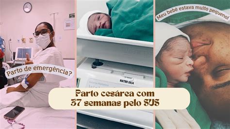 Parto cesárea 37 semanas pelo SUS Parto de emergência Meu bebê