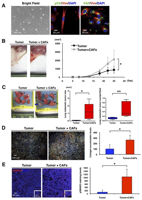 CAFs Promote Primary Tumor Growth And Lung Metastasis In TNBC Mouse