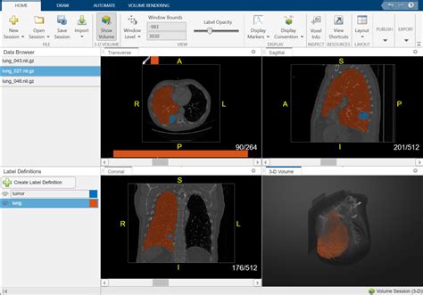 utilizing lively contour automation within the medical picture labeler steve on picture