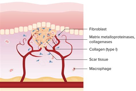 Wound Healing Diagram