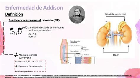 Enfermedad De Addison Escuela Medica Udocz