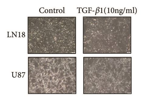 TGF β1 induces EMT in GBM cells a MTT assay of cell viability in