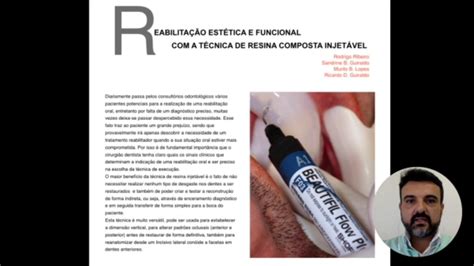 Reabilitação Estética e Funcional a Técnica de Resina Composta