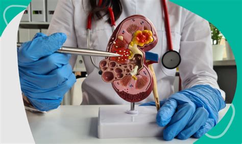 Etapas De La Insuficiencia Renal Un Viaje Hacia La Salud Renal Renium