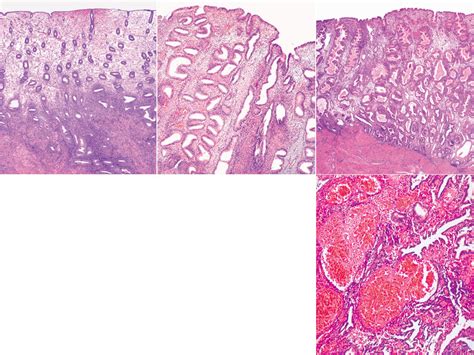 Histology Of The Human Endometrium During The Normal Cycle