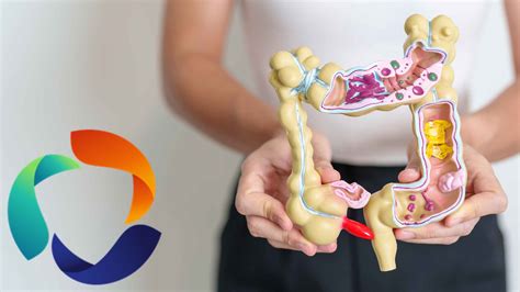 Understanding Colon Cancer Symptoms Causes And Diagnosis SRK