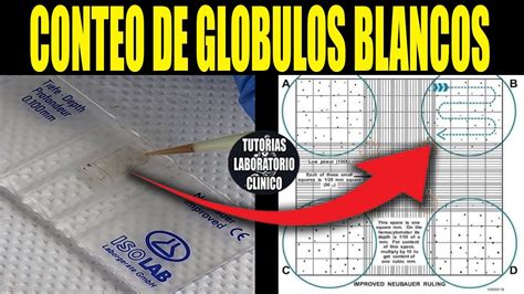 Como Hacer el Conteo de GLÓBULOS BLANCOS en Cámara de Neubauer