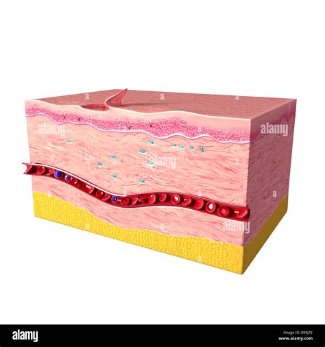 Anatomía de la reparación tisular en la piel humana Fotografía de stock