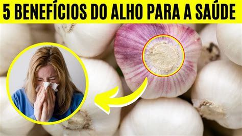 5 Benefícios do Alho Para a Saúde YouTube