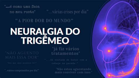 Cirurgia para Tratamento de Neuralgia do Trigêmeo Dr Irlon