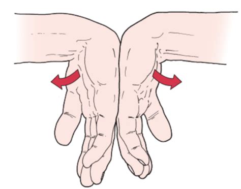 Common Injuries Of Elbow Wrist And Hand Flashcards Quizlet
