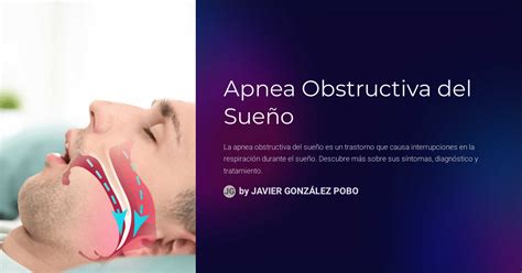 Apnea Obstructiva Del Sue O