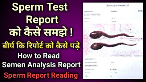 Semen Analysis Test Report How To Read Semen Analysis Report Semen