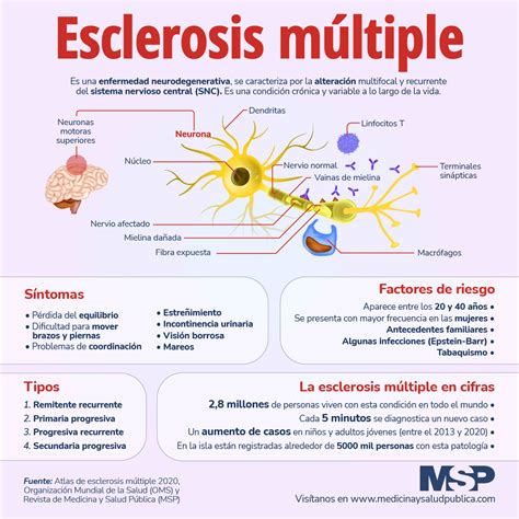 Esclerosis Múltiple Infografía