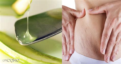 Arriba 97 Imagen Recetas Para Eliminar La Celulitis Abzlocal Mx