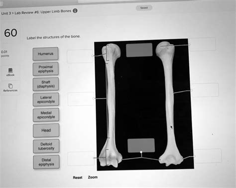 Saved Unit Lab Review Upper Limb Bones Label The Structures Of The