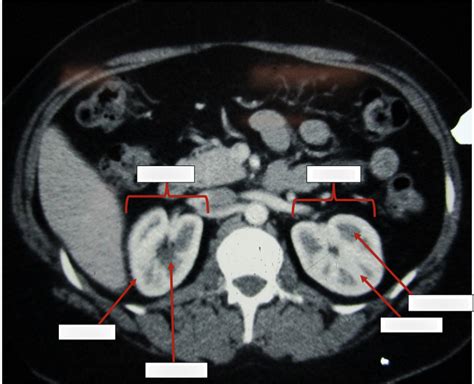 Urinary Ct Scan Diagram Quizlet