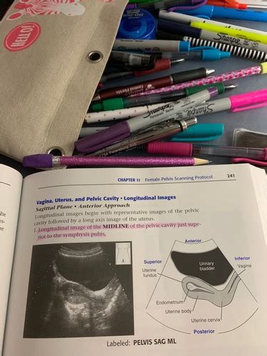 Female Pelvis Scanning Protocol Flashcards Quizlet