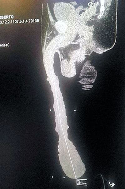 Omg Man With World S Longest Penis Weighed His Manhood You Will Be